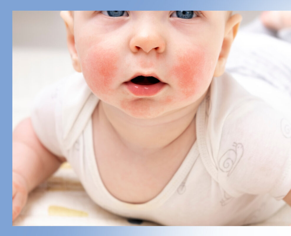 visite dermatologiche - Poliambulatorio Dermatologico