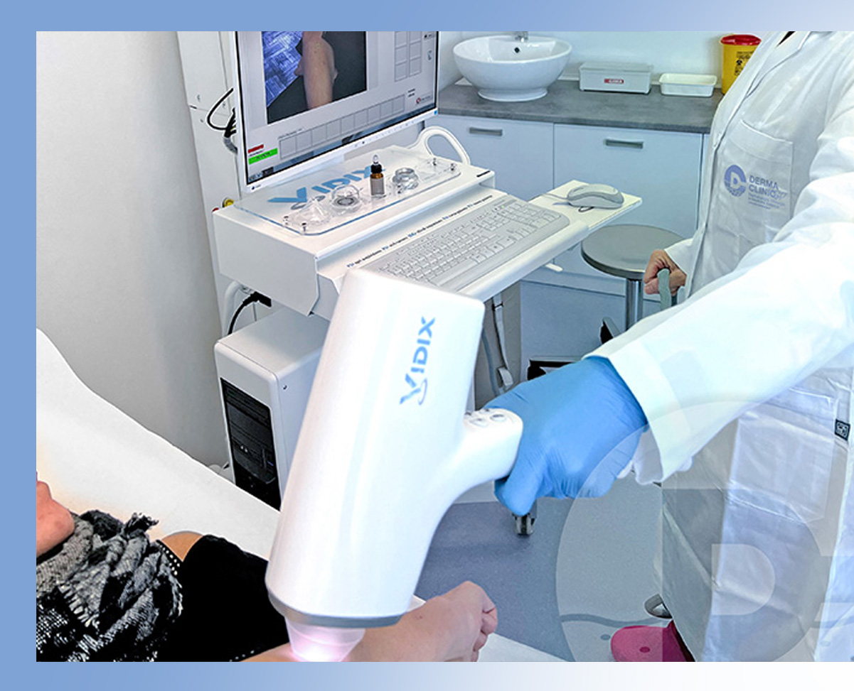 Mappatura nei - Poliambulatorio Dermatologico